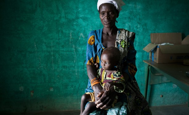 Report Documents Extent of Global Malnutrition - allAfrica.com