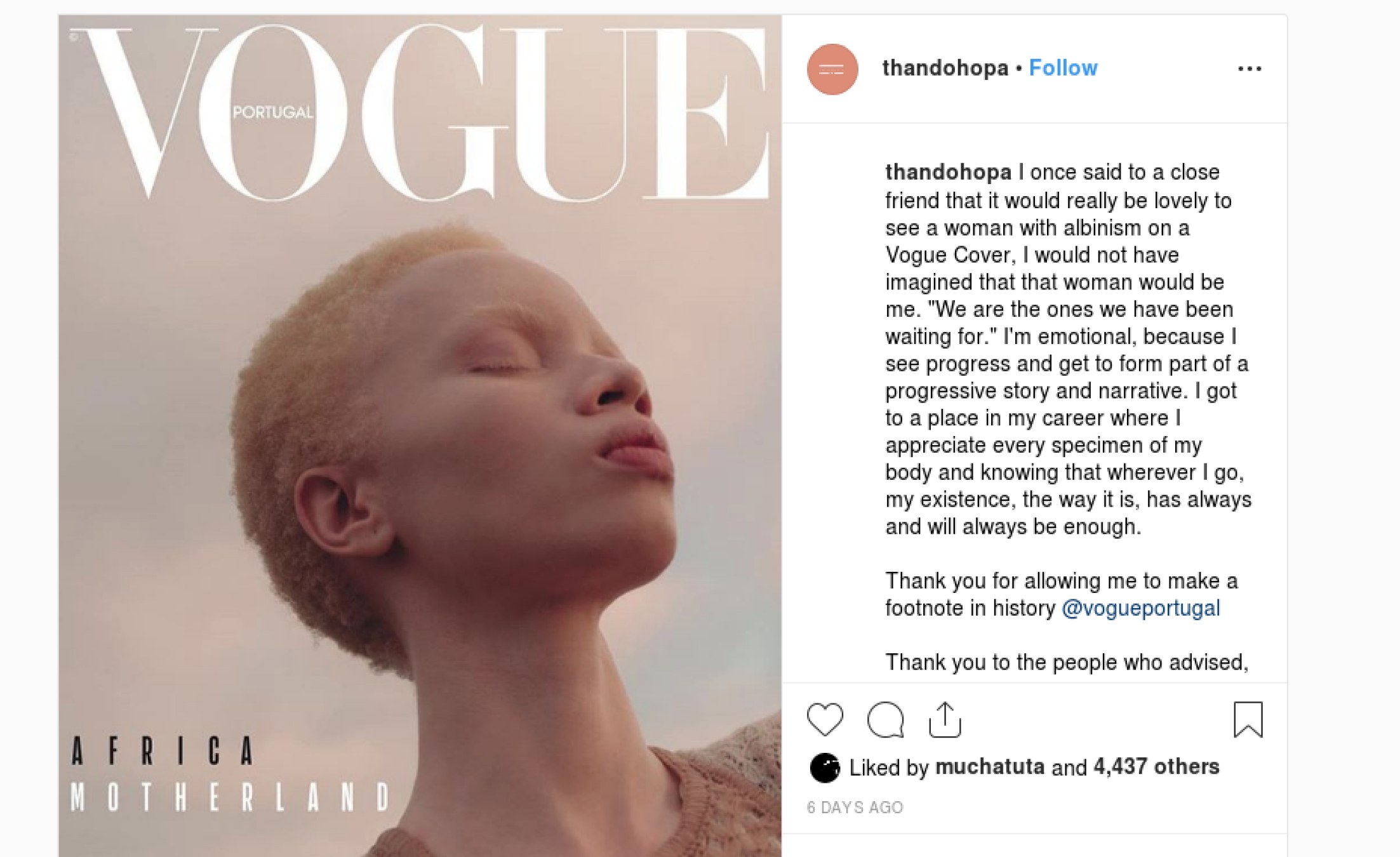 South Africa: Thando Hopa Is the First Woman With Albinism On the Cover ...